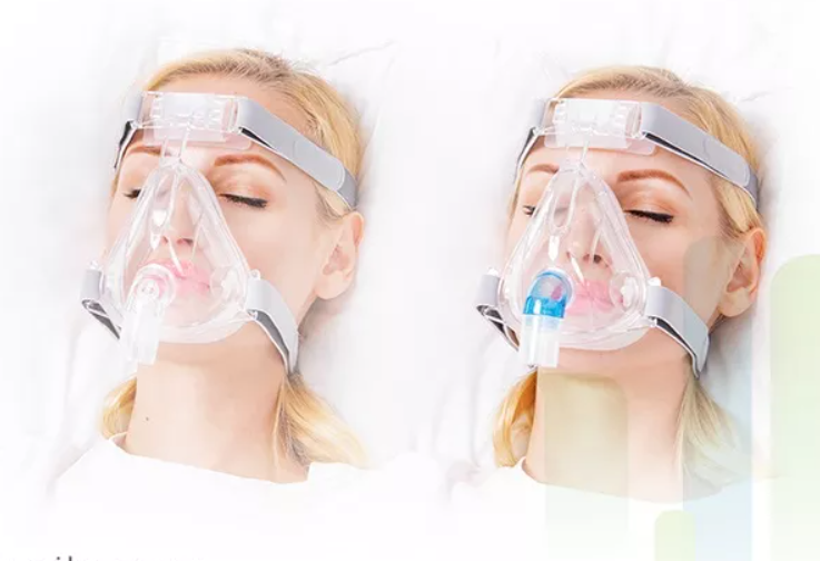 What Is Face Mask Ventilation At Nelson Kennedy Blog